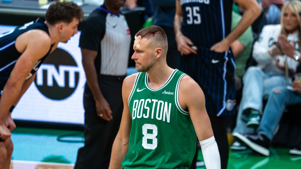 Kristaps Porzingis bloodied after taking elbow to the head – NBC Sports ...